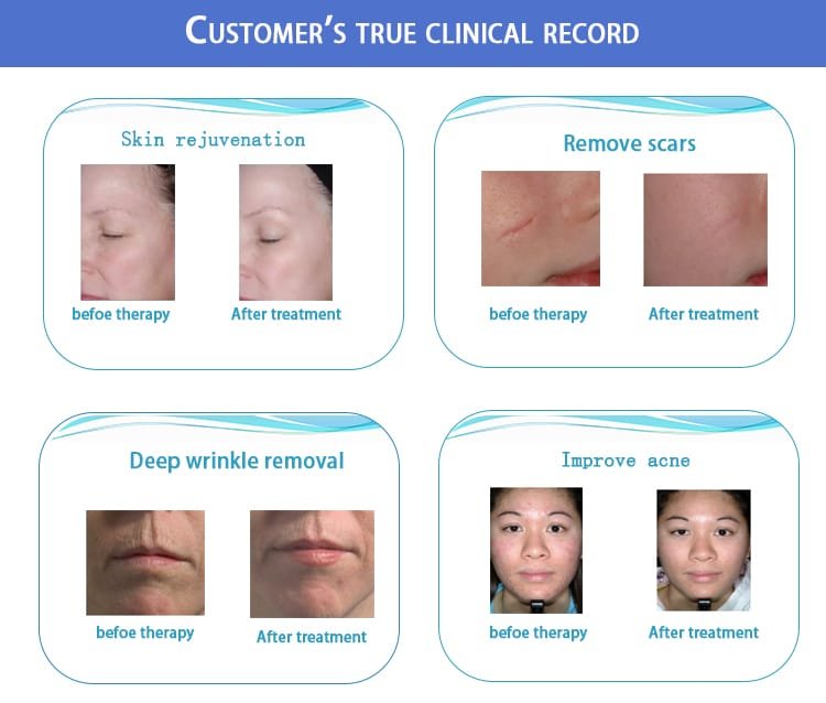 PDT Machine Exporter – Pdtmachine.com